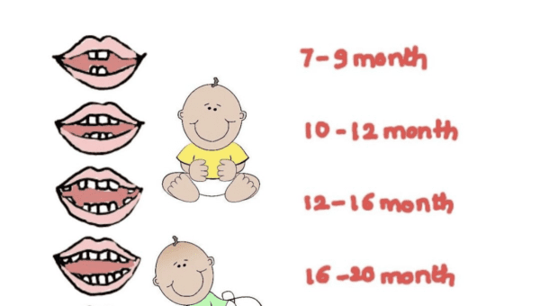 How Many Baby Teeth Should My Child Have? - Bloorkids Dental
